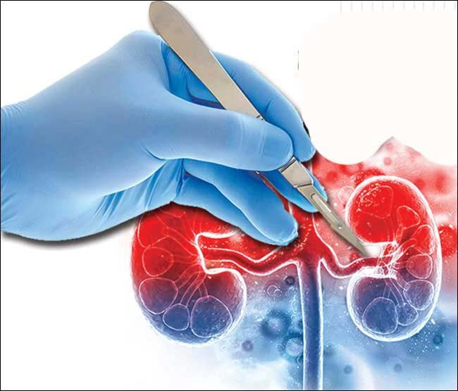 Kidney Racket: కేరళ కిడ్నీ రాకెట్‌లో మరింత మంది | kerala-kidney-racket ...