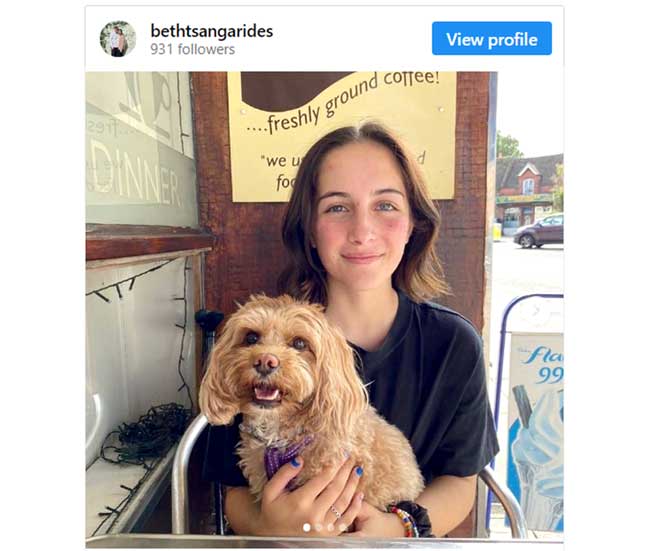 ఈ అందమైన అమ్మాయి.. నవ్వినా, ఏడ్చినా ప్రమాదమేనట | english-woman-beth ...