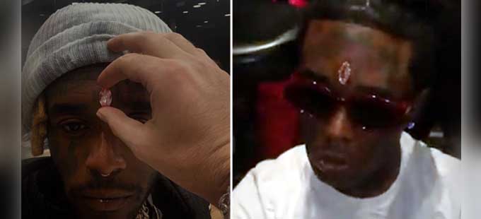 ర్యాపర్‌ నుదుటిపై ₹175 కోట్ల వజ్రం | rapper-implanted-diamond-on-forehead