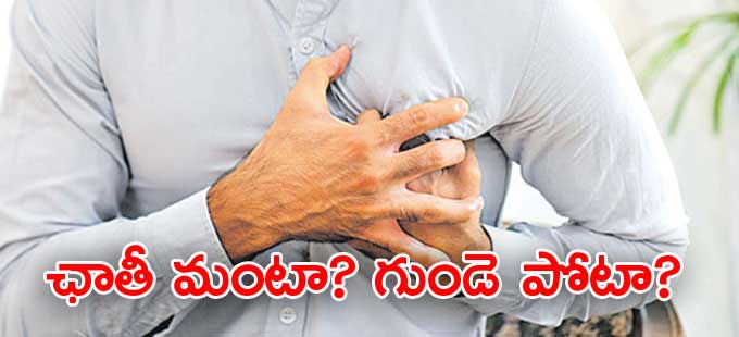 Heart Burn- Heart Attack: ఛాతీ మంటా? గుండె పోటా?.. తెలుసుకోండిలా | here ...