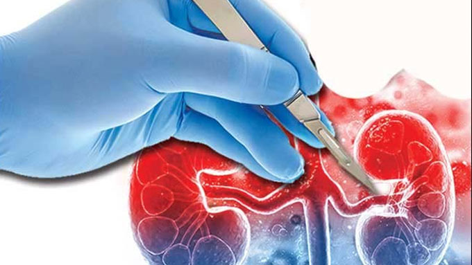 Kidney Racket: కేరళ కిడ్నీ రాకెట్‌లో మరింత మంది | kerala-kidney-racket ...